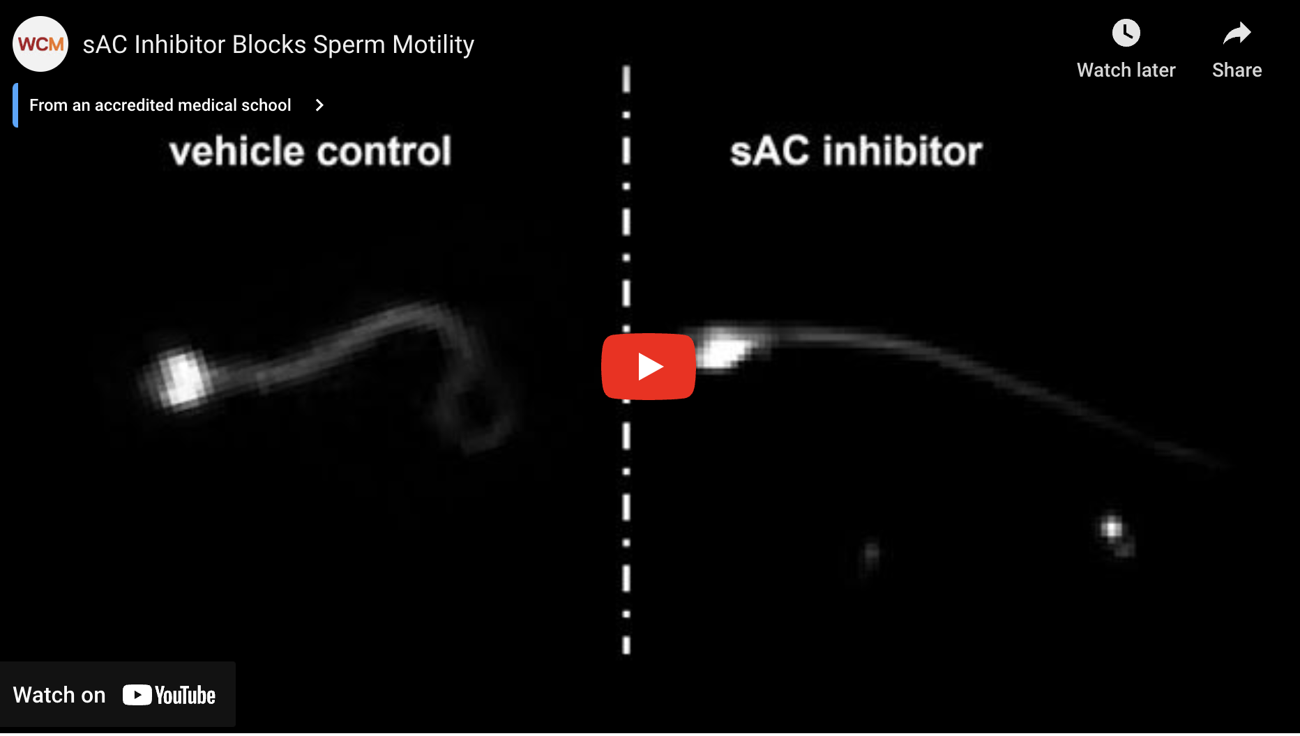 Dr. Santi in "Fast-Acting Nonhormonal Male Birth Control Prevents ...